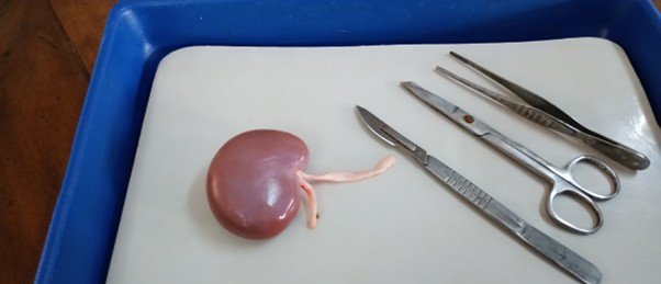 From Beans to Biology: Our Kidney Dissection - Braeburn School